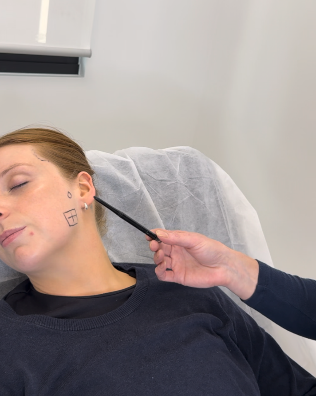 Masseter Reduction & Excessive Teeth Grinding – Southern Dermatology