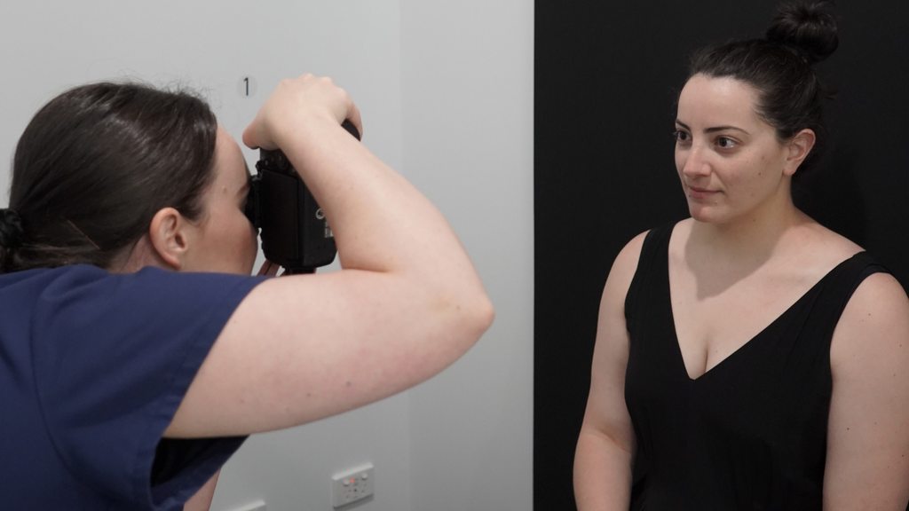 Acne Clinical Trial – Southern Dermatology