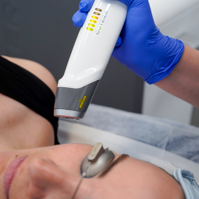 Laser Genesis – Southern Dermatology